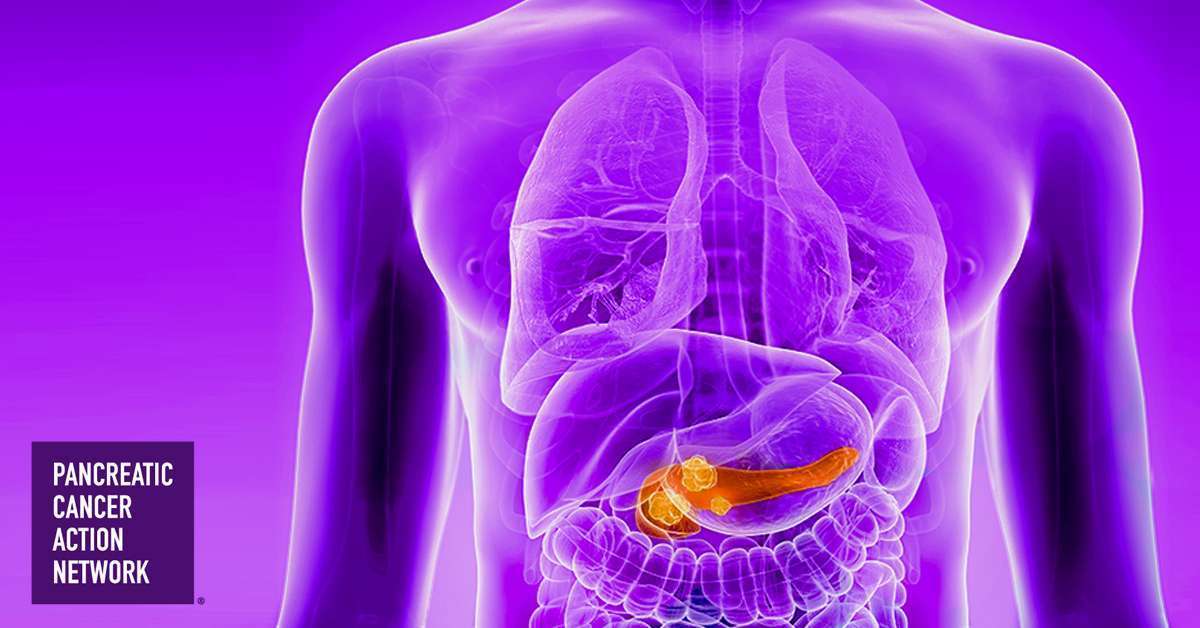 About Pancreatic Cancer - Pancreatic Cancer Action Network